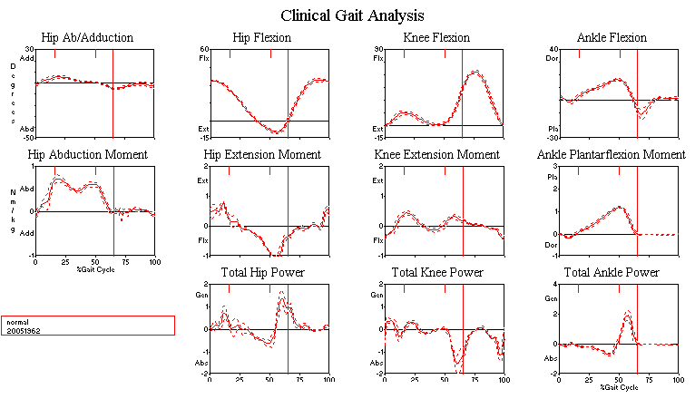 Introduction to Motion Analysis Introduction to Motion Analysis